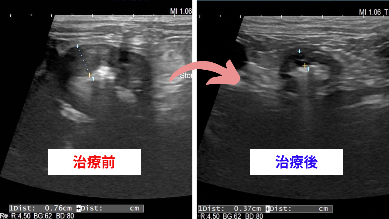 症例紹介：好酸球性硬化性繊維増殖症（GESF） | あらた動物病院｜横浜市旭区善部町の動物病院｜犬 猫｜土日祝日診療